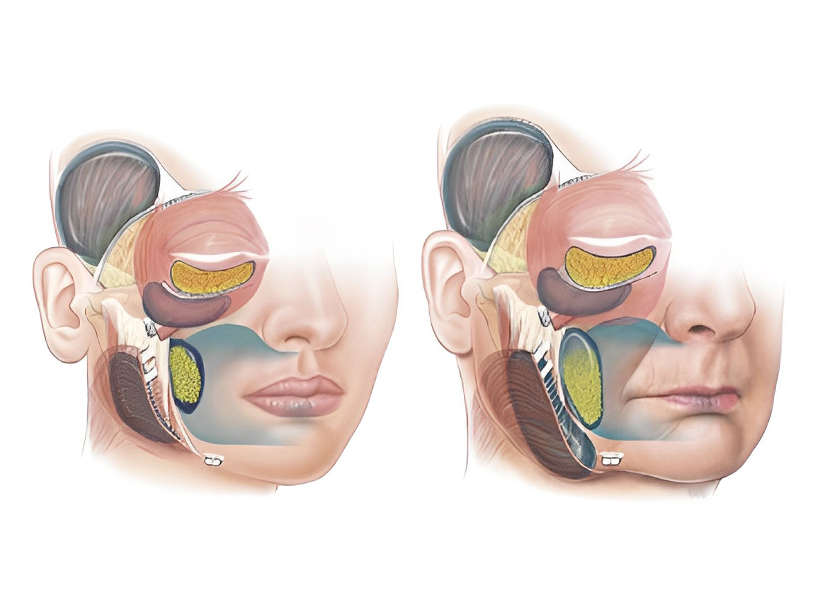 Premature Ageing: Symptoms & Causes | Artiste Plastic Surgery